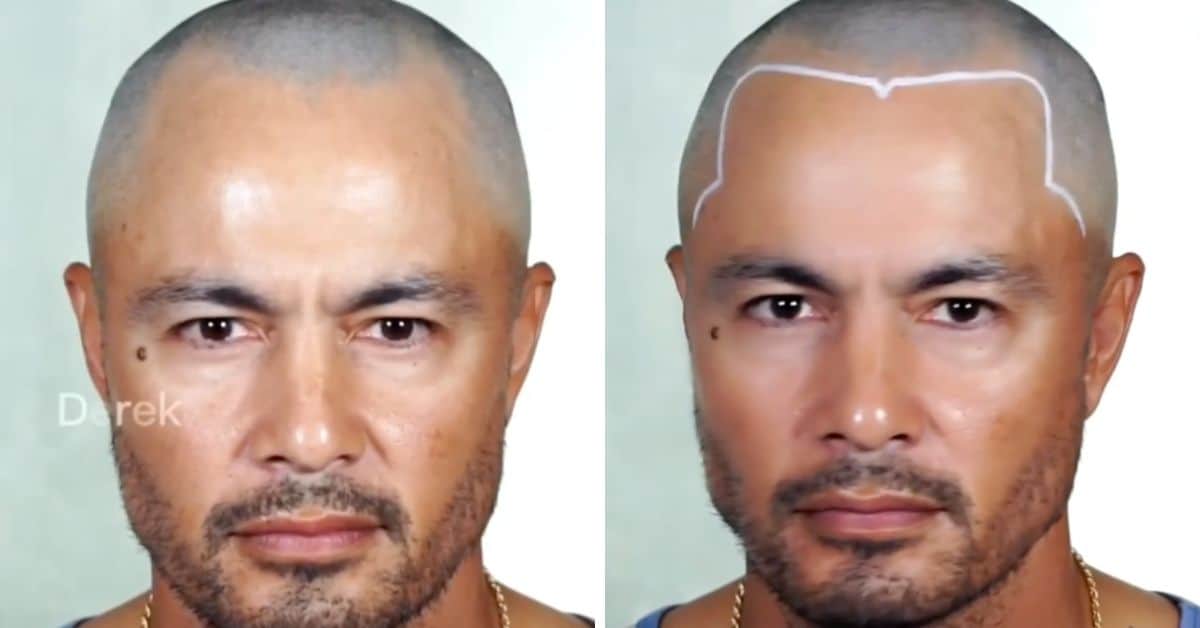 LOOK: Derek Ramsay gets ‘hyperrealistic scalp tattoo’ on hairline ...